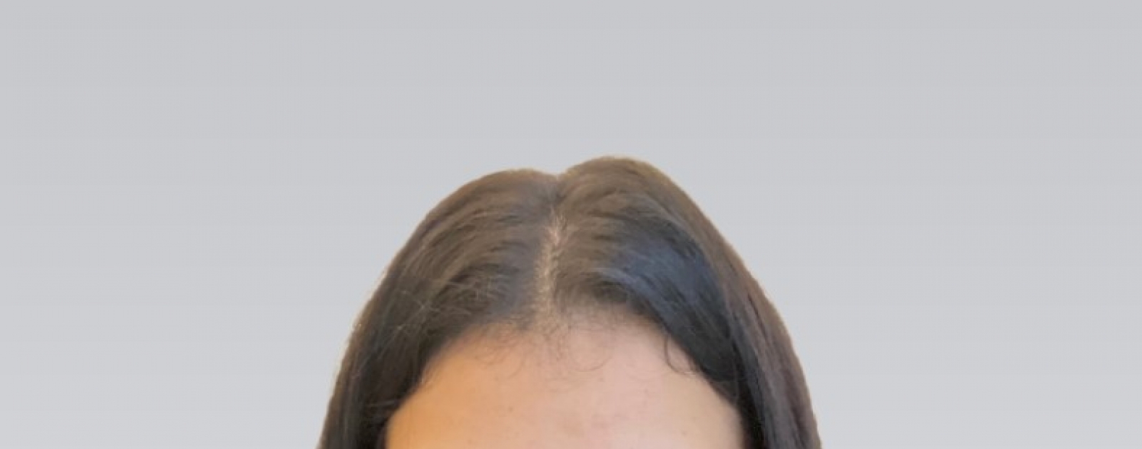 Rim BENNOUNE | LURPA